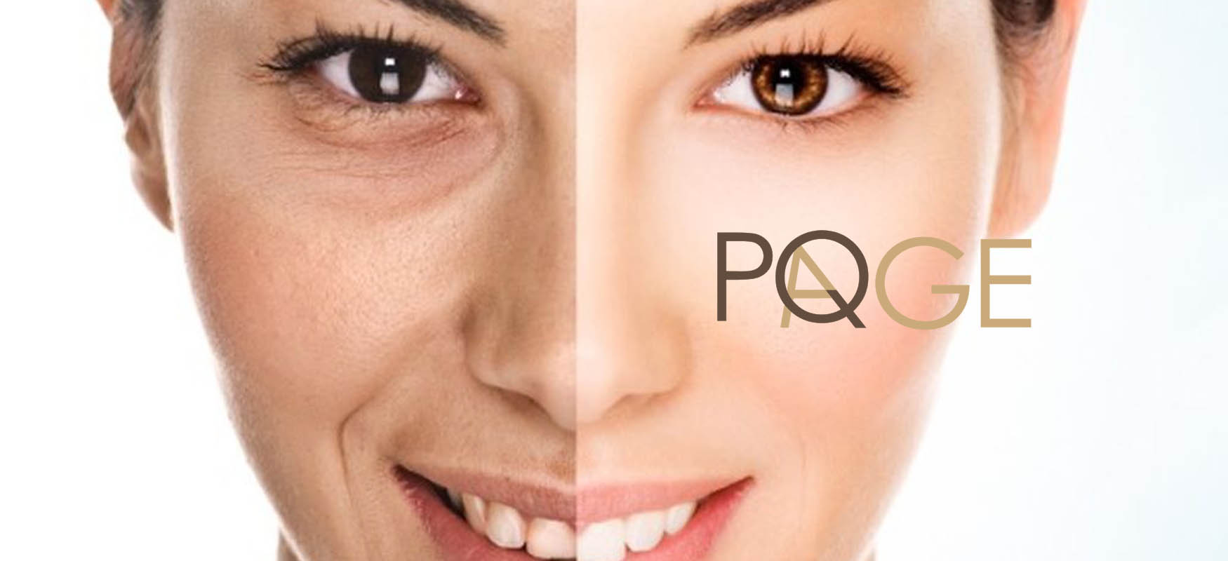 Czym jest PQ Age? Jak przebiega zabieg?