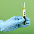 Test CINtec Plus, Badanie HPV → Warszawa