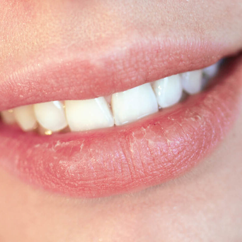 Botox - działanie, efekty i zastosowanie